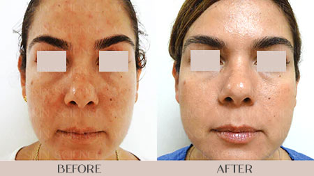 Clinical Trials - AC Skin Science
